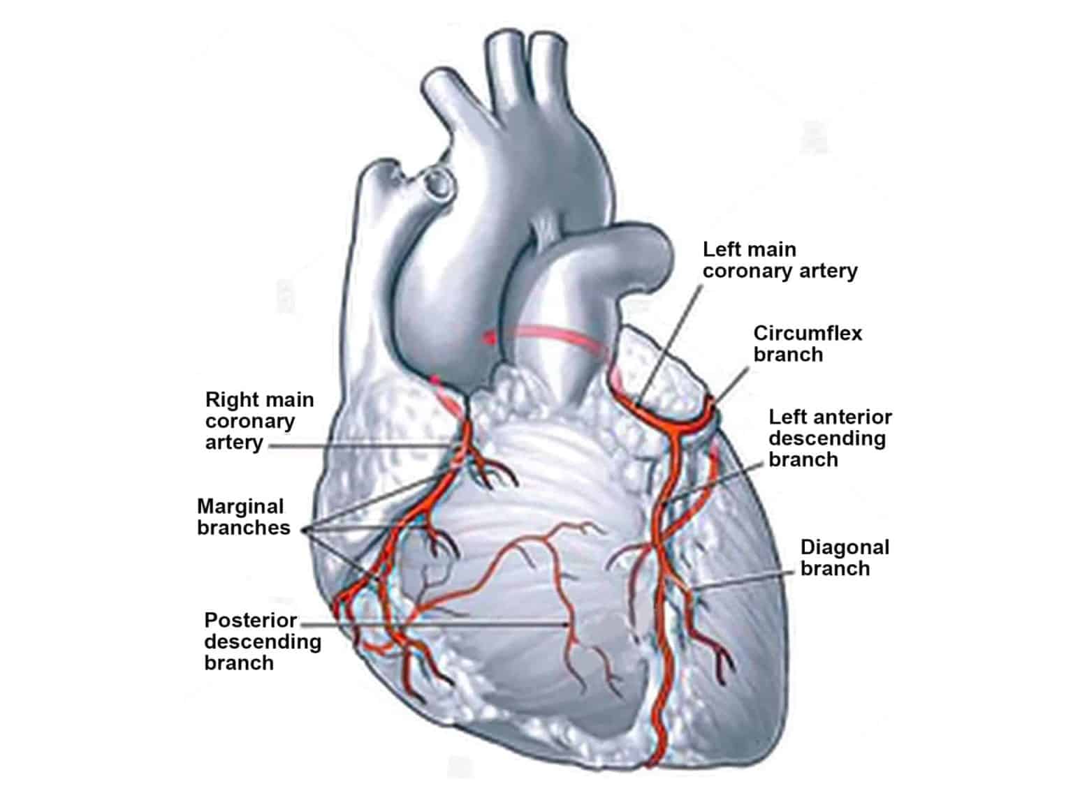What is Heart Blockage/Blocked Arteries?