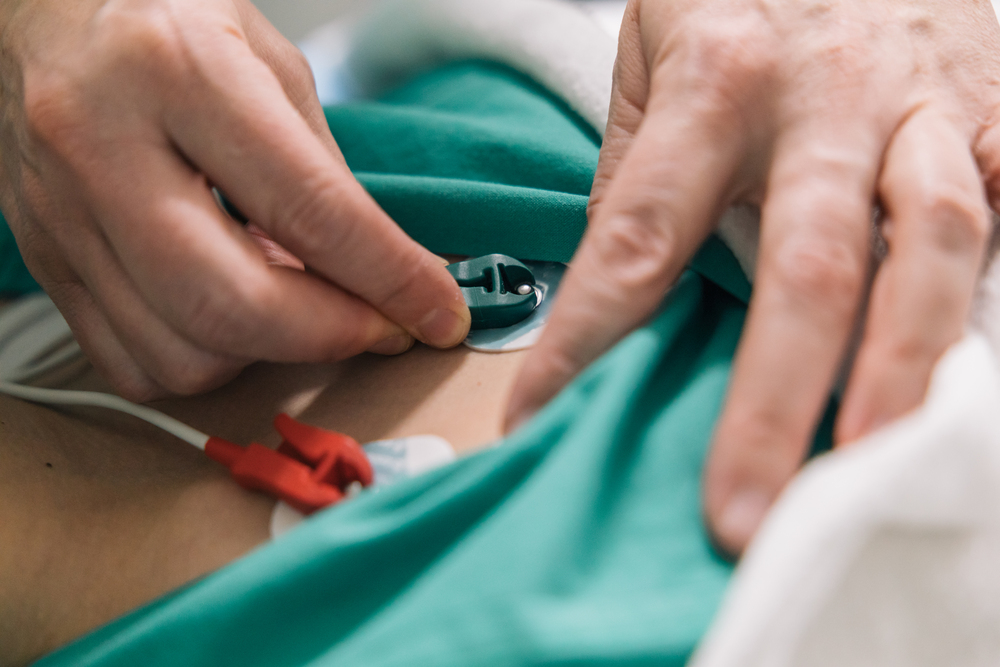 Holter Monitoring